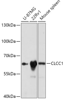 CLCC1 Antibody - Cat. No. 18-029 | ProSci
