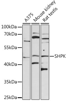 SHPK Antibody - Cat. No. 23-736 | ProSci