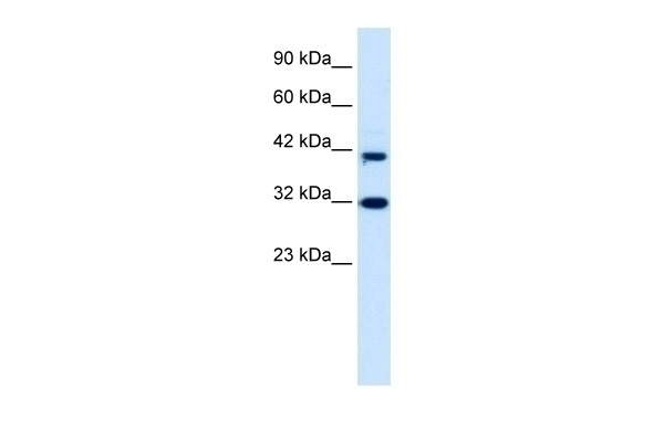 DPF1 Antibody - Cat. No. 28-079 | ProSci