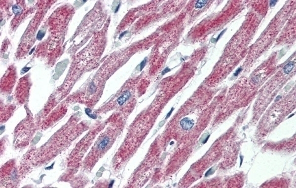 MAS1 Antibody - Cat. No. 30-710 | ProSci
