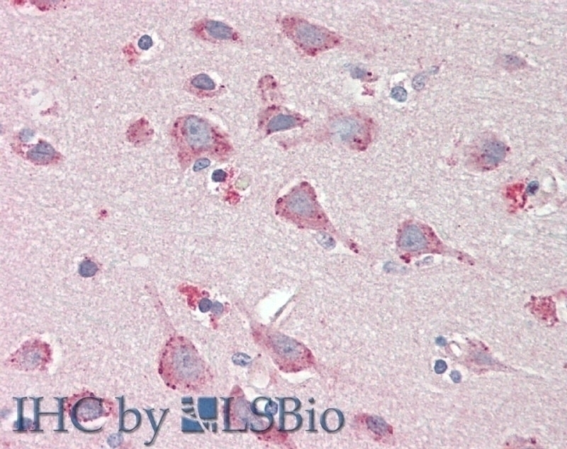 Vimentin Antibody - Cat. No. 43-649 | ProSci