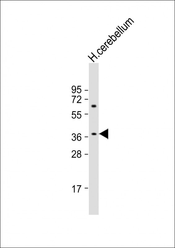 GPR45 Antibody - Cat. No. 56-301 | ProSci