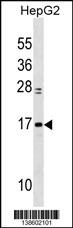 MYL6 Antibody - Cat. No. 59-890 | ProSci