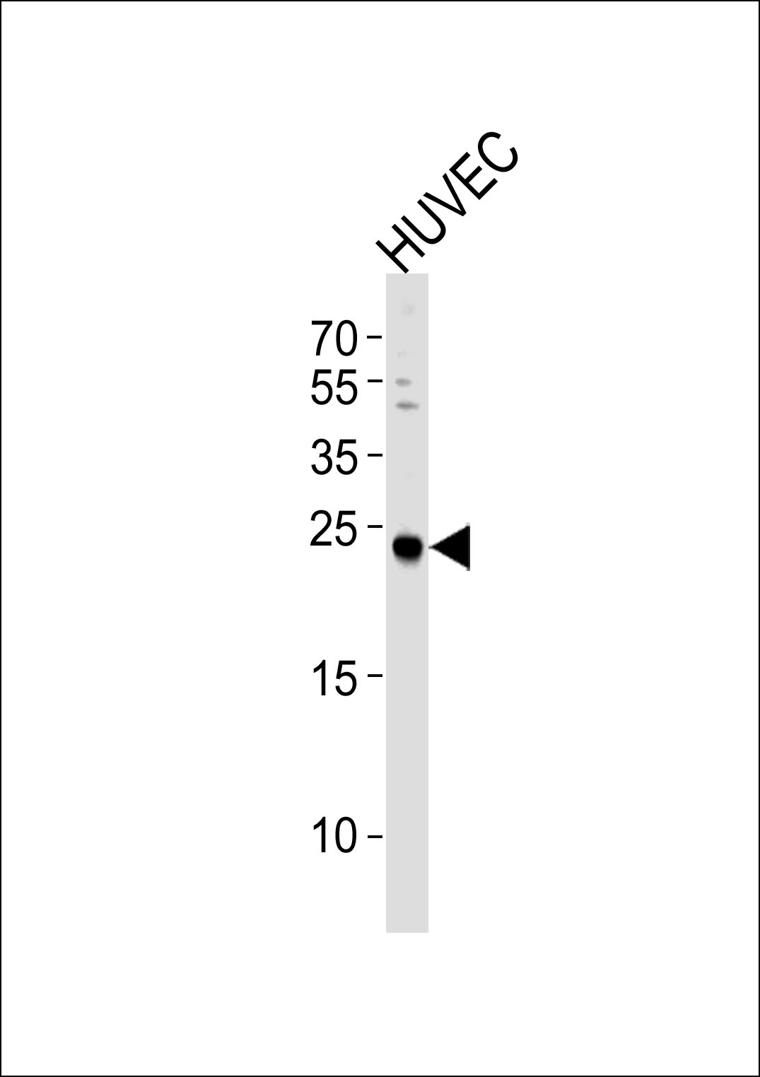 CSNK2B Antibody - Cat. No. 62-639 | ProSci