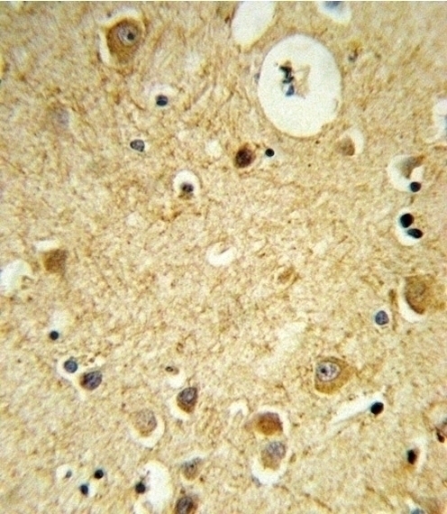 RECK Antibody - Cat. No. 63-860 | ProSci