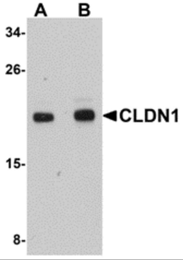 CLDN1 Antibody - Cat. No. 5187 | ProSci