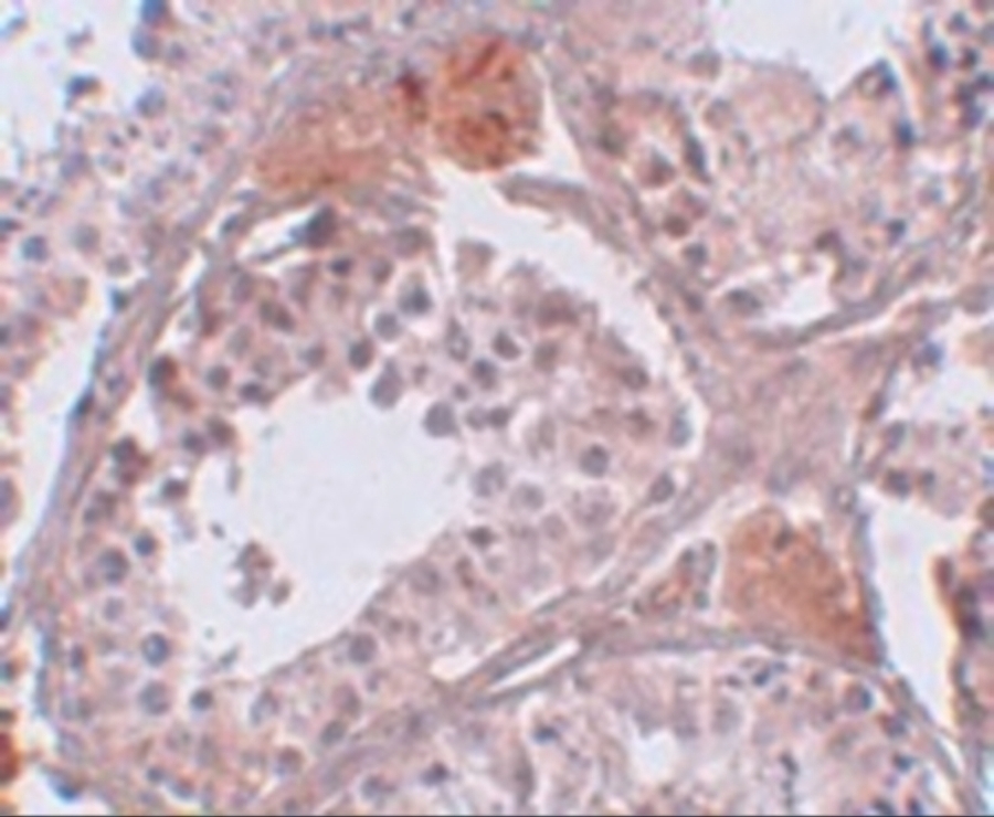 CLPH Antibody - Cat. No. 5497 | ProSci