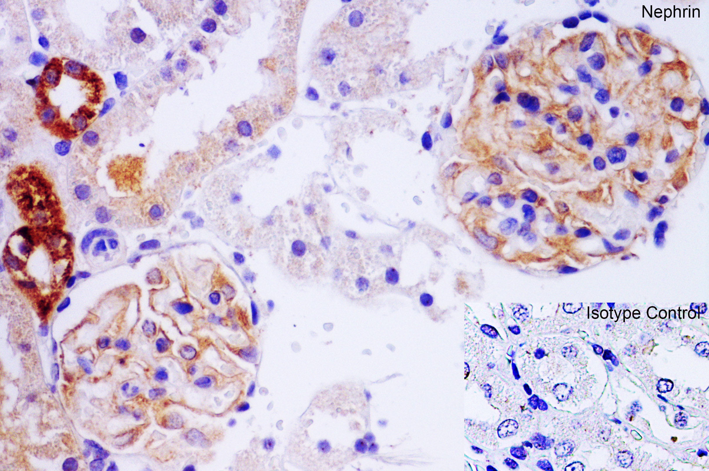 Nephrin Antibody - Cat. No. 2265 | ProSci